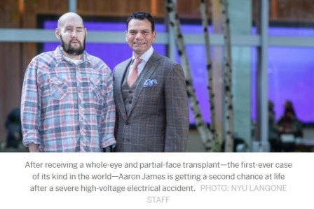 - NYU Langone Health Performs World’s First Whole-Eye & Partial-Face ...